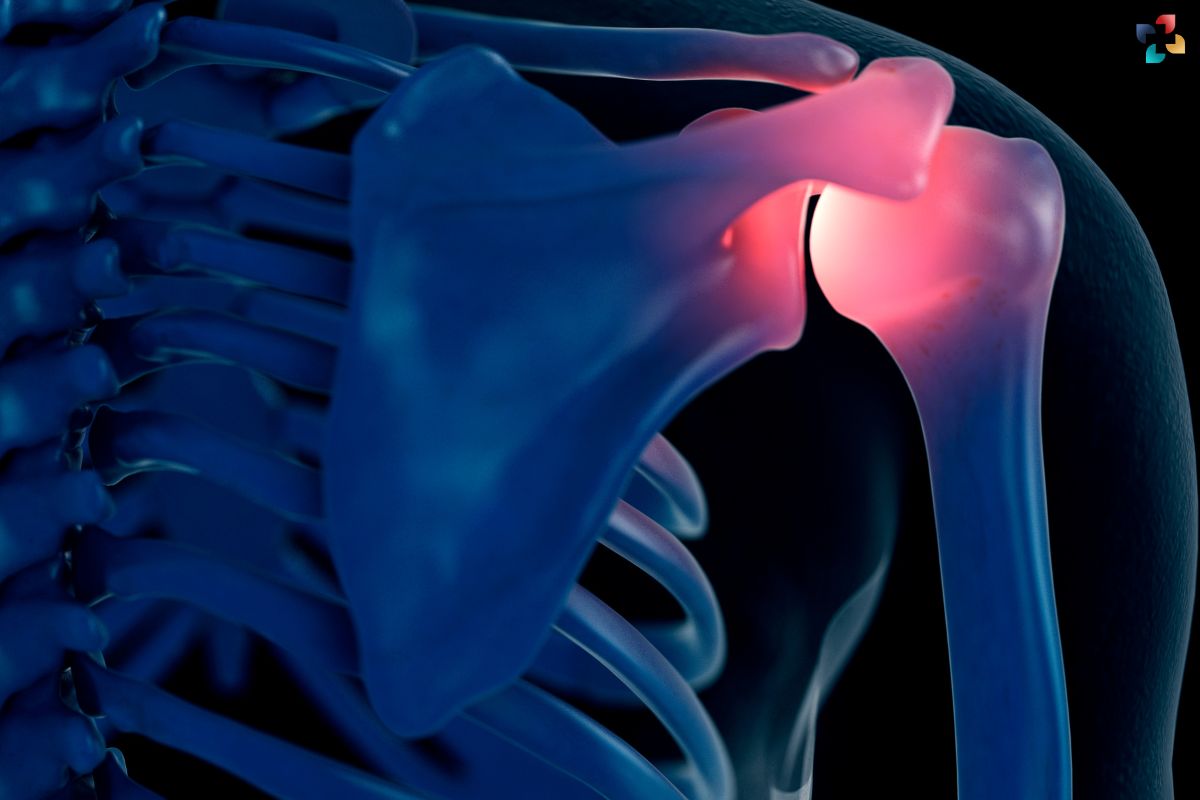 Understanding Glenoid Labrum Tear Symptoms Causes Treatment And